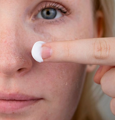 Descamação da pele: dermatologista explica causas e como tratar