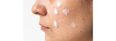 Cravos no rosto: o que causa e como tirar sem deixar marcas? | Garnier